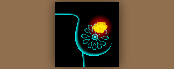 The Dynamics Of Ductal Tree Remodeling Shape Mammary Field Cancerization Cancer Discovery News 