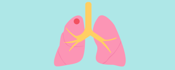 ALK TKI Earns FDA Approval | Cancer Discovery News | American ...
