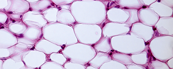 MIF–ACKR3 Signaling Drives Cancer Cachexia by Impairing Adipogenesis ...