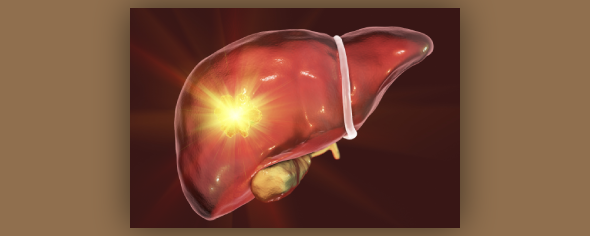 ACLY Targeting Enhances Immunity and Suppresses MASH-driven Liver ...
