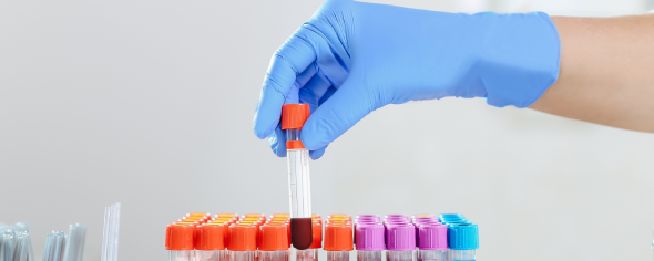 Blood Test for 50+ Cancer Types Launches | Cancer Discovery News ...