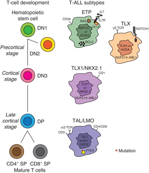 T-cell Acute Lymphoblastic Leukemia: A Roadmap to Targeted Therapies ...