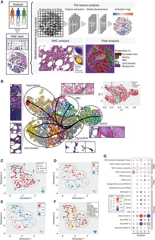 Machine Learning of Bone Marrow Histopathology Identifies Genetic and ...