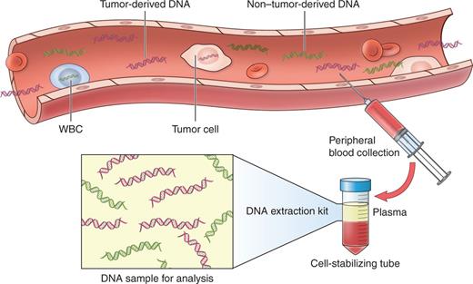 Circulating Tumor DNA in Lymphoma: Principles and Future Directions ...