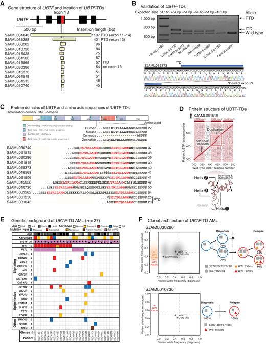 Integrated Genomic Analysis Identifies UBTF Tandem Duplications as a Recurrent Lesion in ...