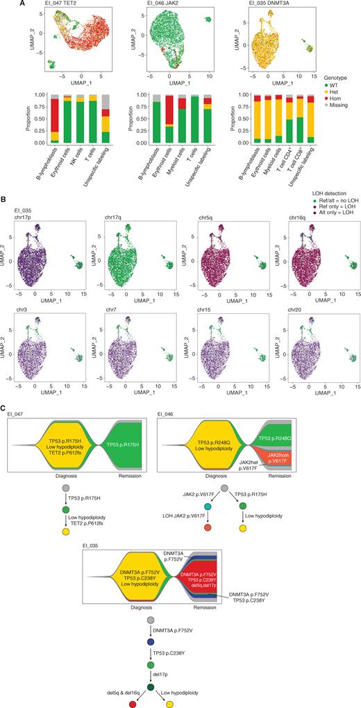 Adult Low-Hypodiploid Acute Lymphoblastic Leukemia Emerges from ...