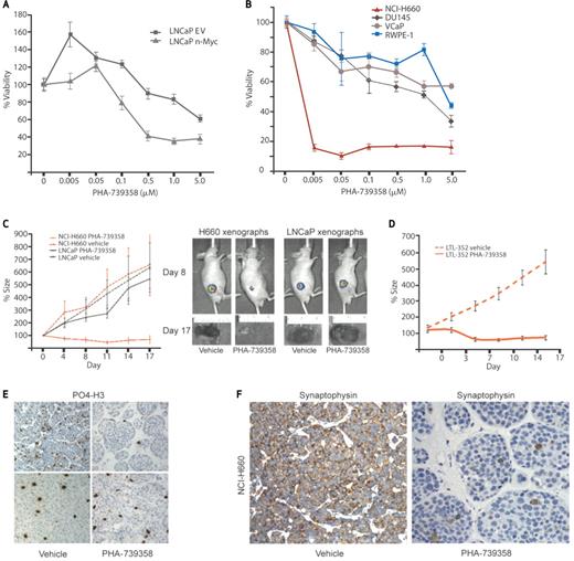 Molecular Characterization of Neuroendocrine Prostate Cancer and ...