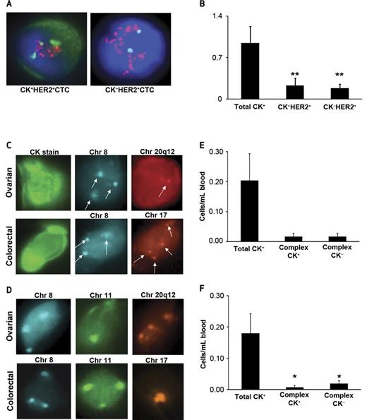 A Novel Platform for Detection of CK+ and CK− CTCs | Cancer Discovery ...