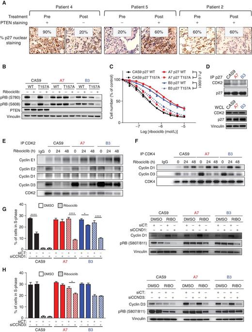 PTEN Loss Mediates Clinical Cross-Resistance to CDK4/6 and PI3Kα ...