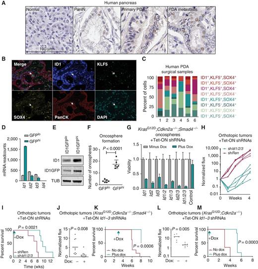 ID1 Mediates Escape from TGFβ Tumor Suppression in Pancreatic Cancer ...