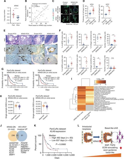 Intraductal Transplantation Models of Human Pancreatic Ductal ...