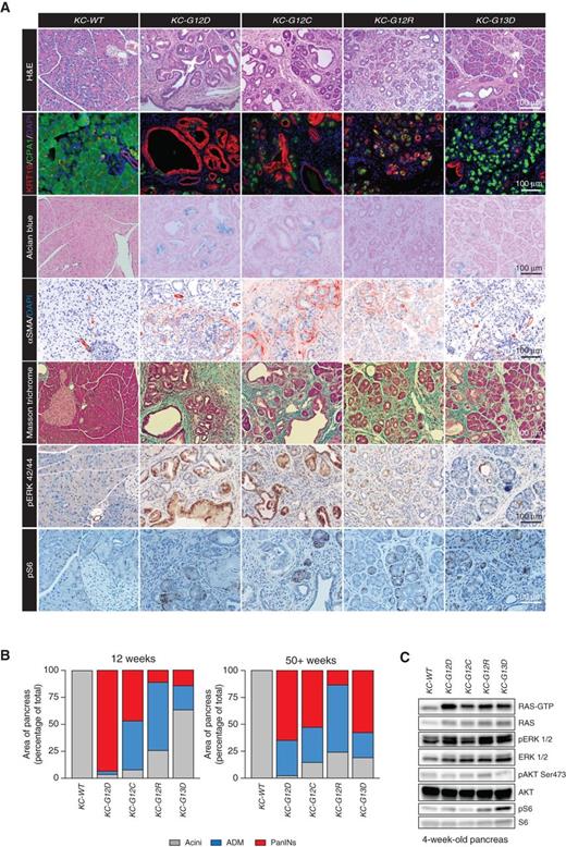An In Vivo Kras Allelic Series Reveals Distinct Phenotypes of Common ...