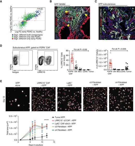 Single-Cell RNA Sequencing Reveals Stromal Evolution into LRRC15 ...