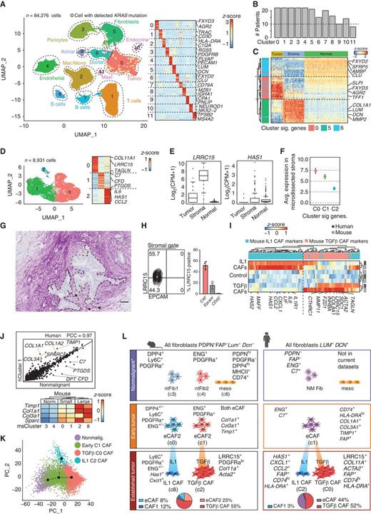 Single-Cell RNA Sequencing Reveals Stromal Evolution into LRRC15 ...