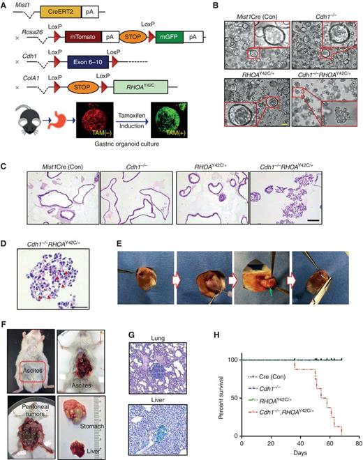 Gain-of-Function RHOA Mutations Promote Focal Adhesion Kinase ...