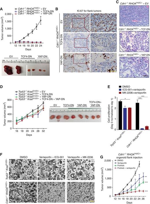 Gain-of-Function RHOA Mutations Promote Focal Adhesion Kinase ...