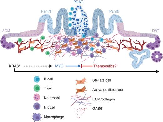 Deconstructing Pancreatic Adenocarcinoma by Targeting the Conductor ...