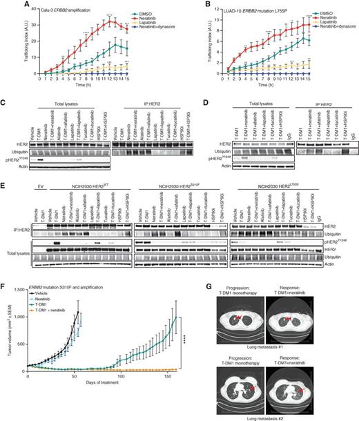 HER2-Mediated Internalization of Cytotoxic Agents in ERBB2 Amplified or ...