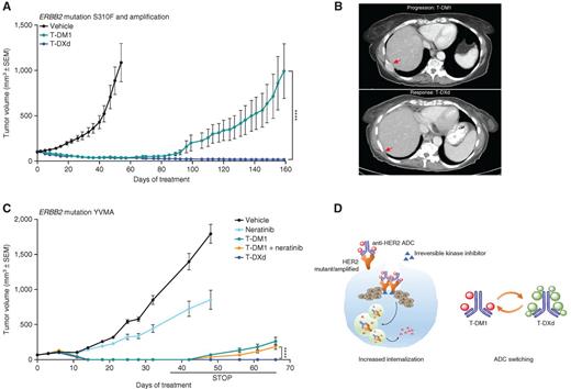 HER2-Mediated Internalization of Cytotoxic Agents in ERBB2 Amplified or ...