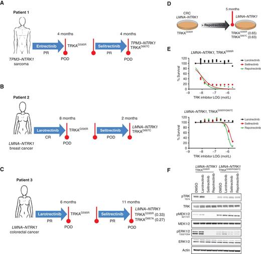 TRK xDFG Mutations Trigger a Sensitivity Switch from Type I to II ...
