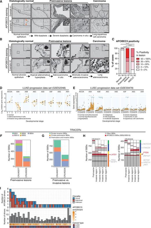 Induction of APOBEC3 Exacerbates DNA Replication Stress and Chromosomal ...