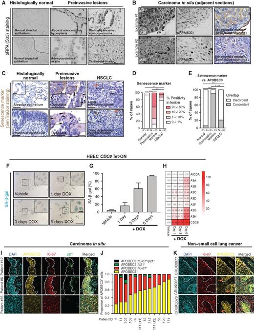 Induction of APOBEC3 Exacerbates DNA Replication Stress and Chromosomal ...