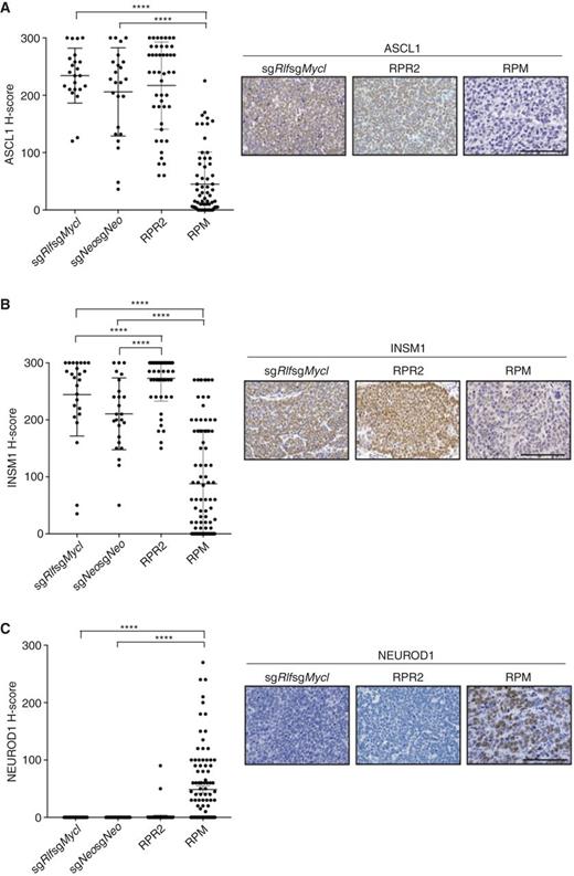 Rlf–Mycl Gene Fusion Drives Tumorigenesis and Metastasis in a Mouse ...