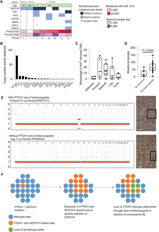 Selection of Oncogenic Mutant Clones in Normal Human Skin Varies with ...