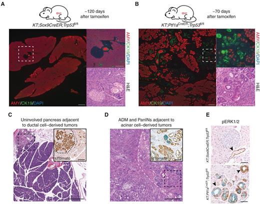 Cell of Origin Influences Pancreatic Cancer Subtype | Cancer Discovery ...