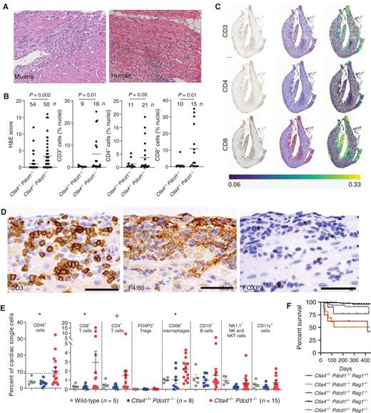 A Genetic Mouse Model Recapitulates Immune Checkpoint Inhibitor ...