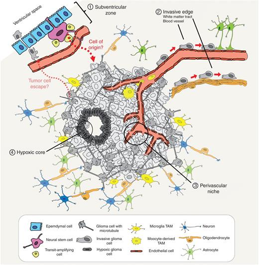 Diffuse Glioma Heterogeneity and Its Therapeutic Implications | Cancer ...