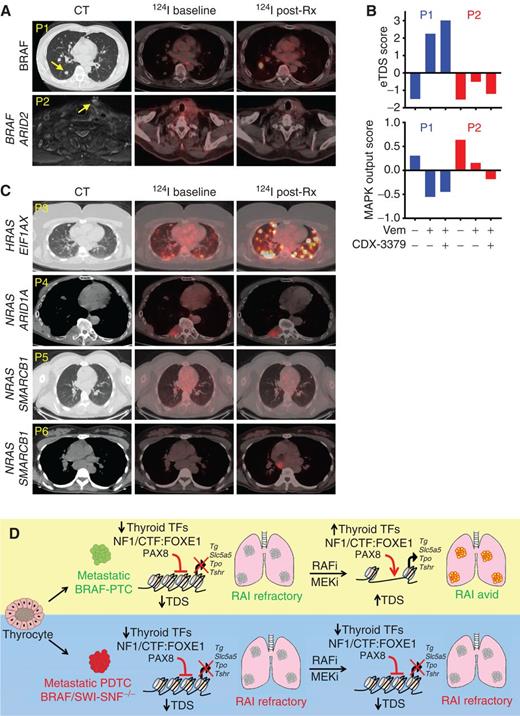 SWI/SNF Complex Mutations Promote Thyroid Tumor Progression and ...