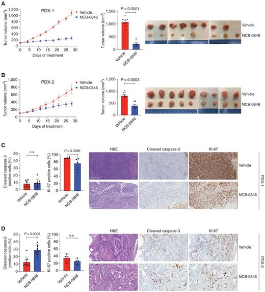 TNIK Is a Therapeutic Target in Lung Squamous Cell Carcinoma and ...
