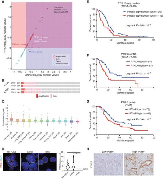 PTHrP Drives Pancreatic Cancer Growth and Metastasis and Reveals a New ...
