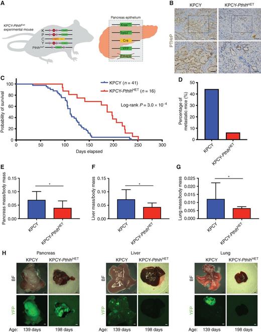 PTHrP Drives Pancreatic Cancer Growth and Metastasis and Reveals a New ...