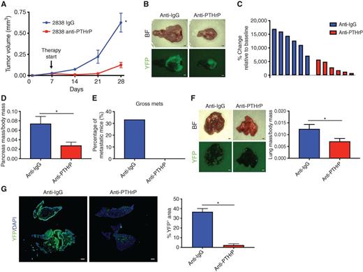 PTHrP Drives Pancreatic Cancer Growth and Metastasis and Reveals a New ...