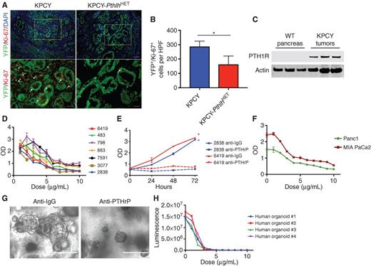 PTHrP Drives Pancreatic Cancer Growth and Metastasis and Reveals a New ...