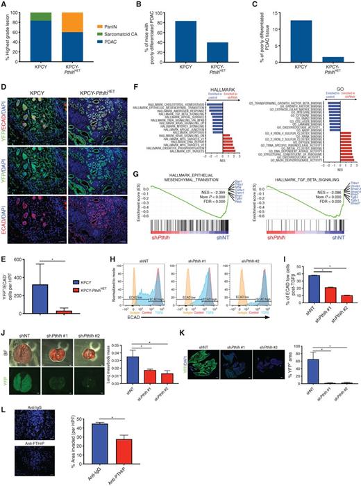 PTHrP Drives Pancreatic Cancer Growth and Metastasis and Reveals a New ...