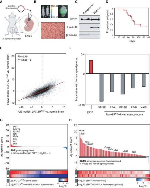 ZFTA–RELA Dictates Oncogenic Transcriptional Programs to Drive ...