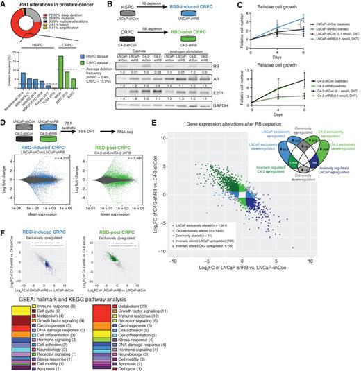 RB/E2F1 as a Master Regulator of Cancer Cell Metabolism in Advanced ...