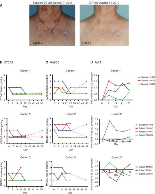 Reducing Skin Toxicities from EGFR Inhibitors with Topical BRAF ...