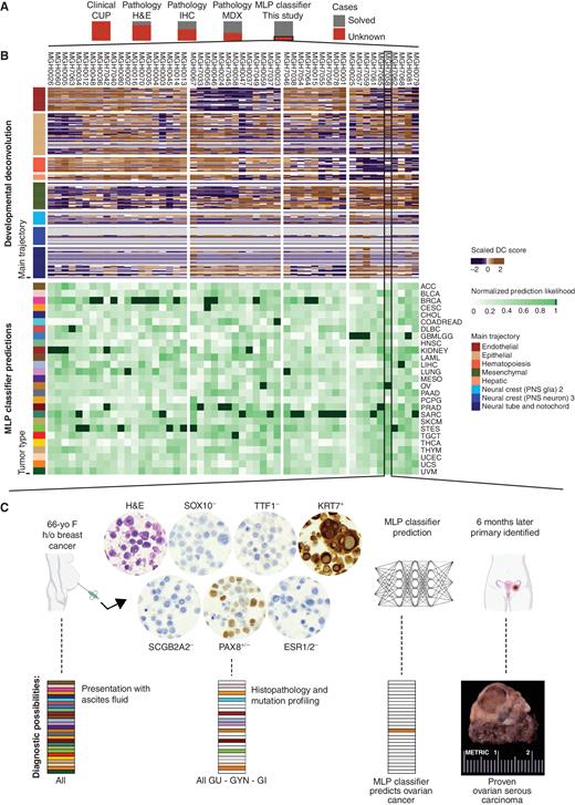 Developmental Deconvolution for Classification of Cancer Origin | Cancer Discovery | American ...