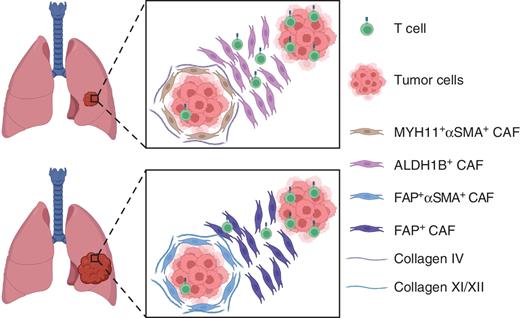 Lung CAFs Show T Cells the Velvet Rope | Cancer Discovery | American ...