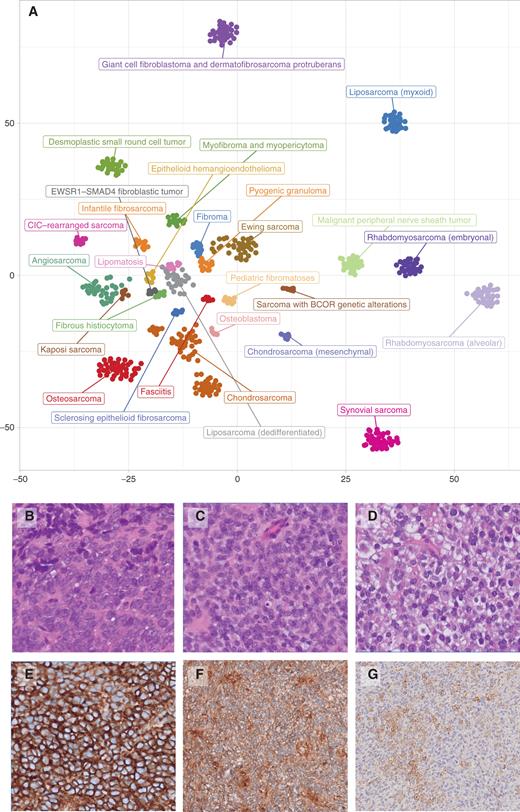 A Summary of the Inaugural WHO Classification of Pediatric Tumors ...