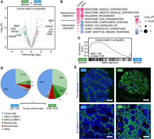 Colorectal Cancer Organoid–Stroma Biobank Allows Subtype-Specific Assessment of Individualized ...