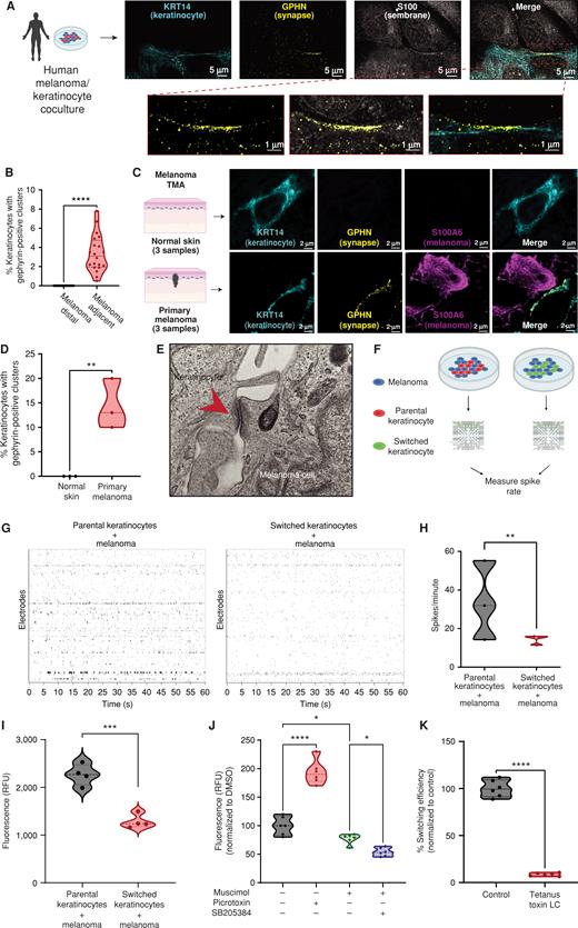 GABA Regulates Electrical Activity and Tumor Initiation in Melanoma ...
