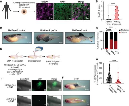 GABA Regulates Electrical Activity and Tumor Initiation in Melanoma ...
