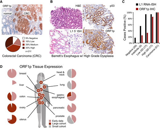 Ultrasensitive Detection of Circulating LINE-1 ORF1p as a Specific Multicancer Biomarker ...