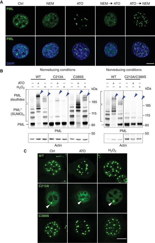Structural Basis of PML-RARA Oncoprotein Targeting by Arsenic Unravels ...