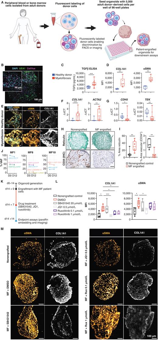 Human Bone Marrow Organoids for Disease Modeling, Discovery, and ...